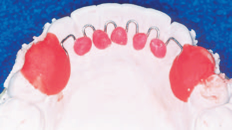 Welcome to Triple O Dental Laboratories | Triple O