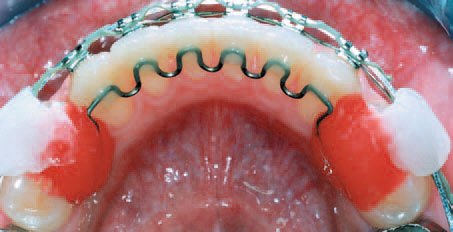 Welcome to Triple O Dental Laboratories | Triple O