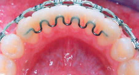 Welcome to Triple O Dental Laboratories | Triple O